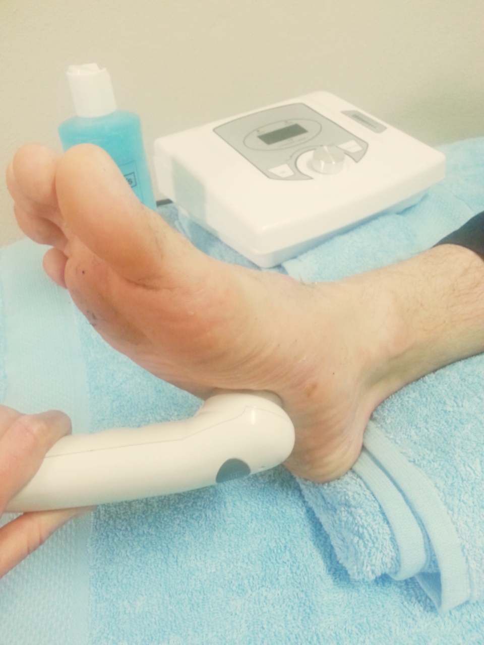 Treatments - Suncoast Podiatry